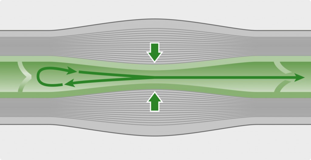 How Matrix Rhythm Therapy (MaRhyThe) Works – Dr. Randoll Institut ...